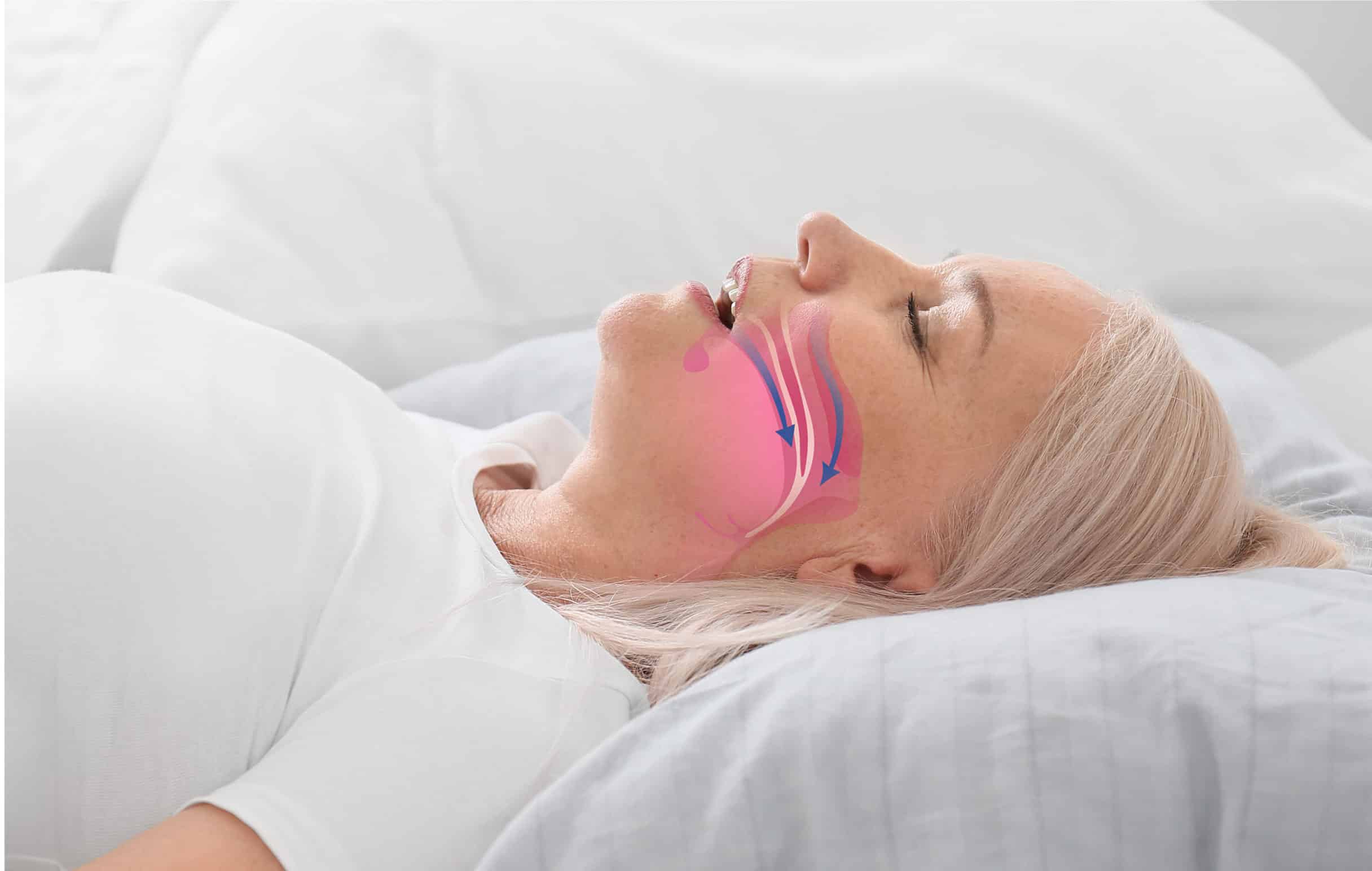 How Sleep Apnea Affects Heart Health | Newport Beach Dentist